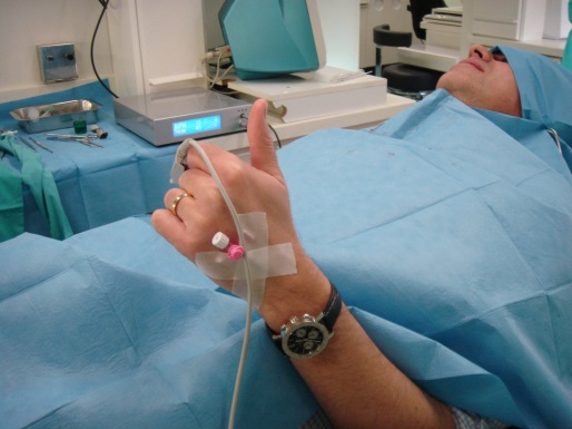 sedación mínima y moderada - Gamma Knife